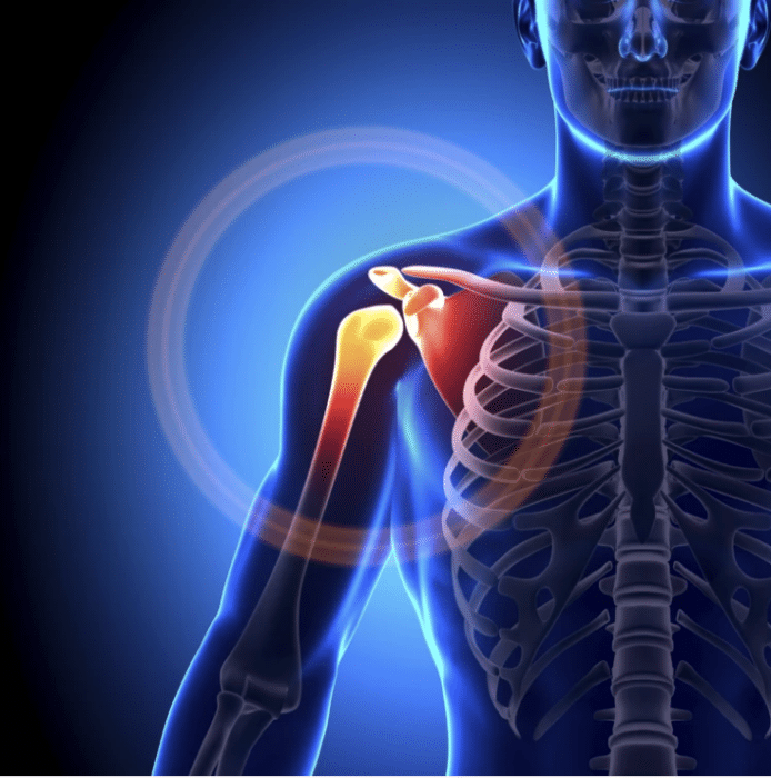 Shoulder Rehab™ Official Retailer - Orthopedic Brace